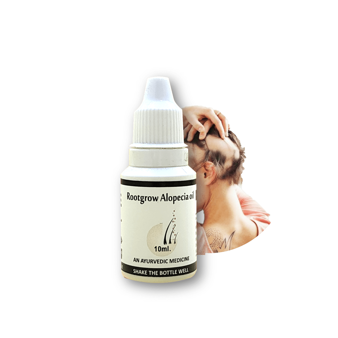 Alopecia Oil | Hair Regrowths Oil | Hair regrwoth serum